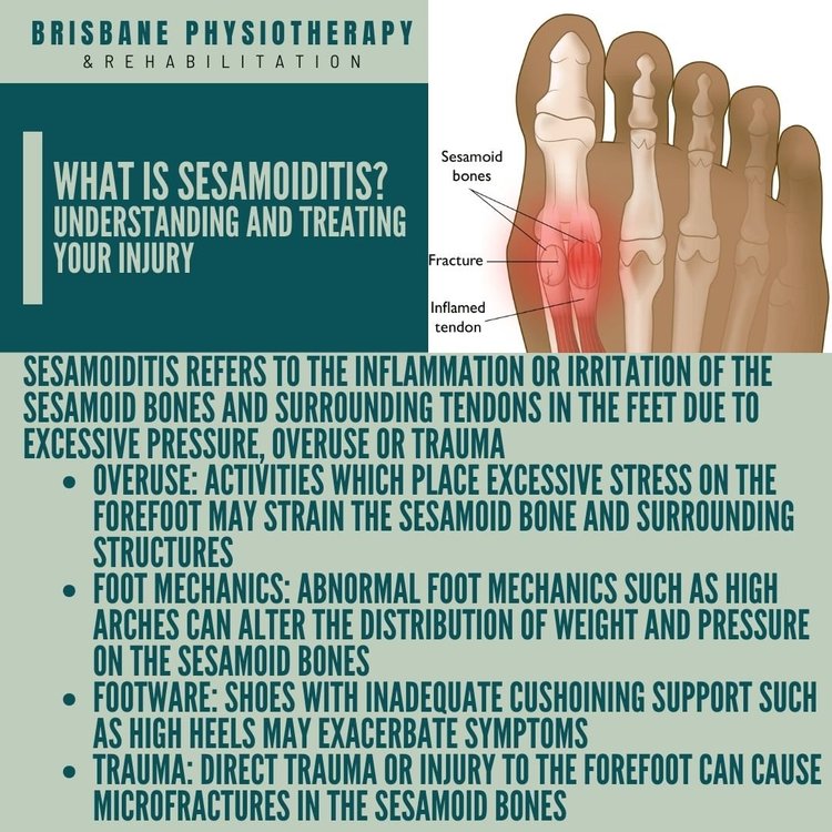 What is Sesamoiditis? - Brisbane Physiotherapy & Podiatry