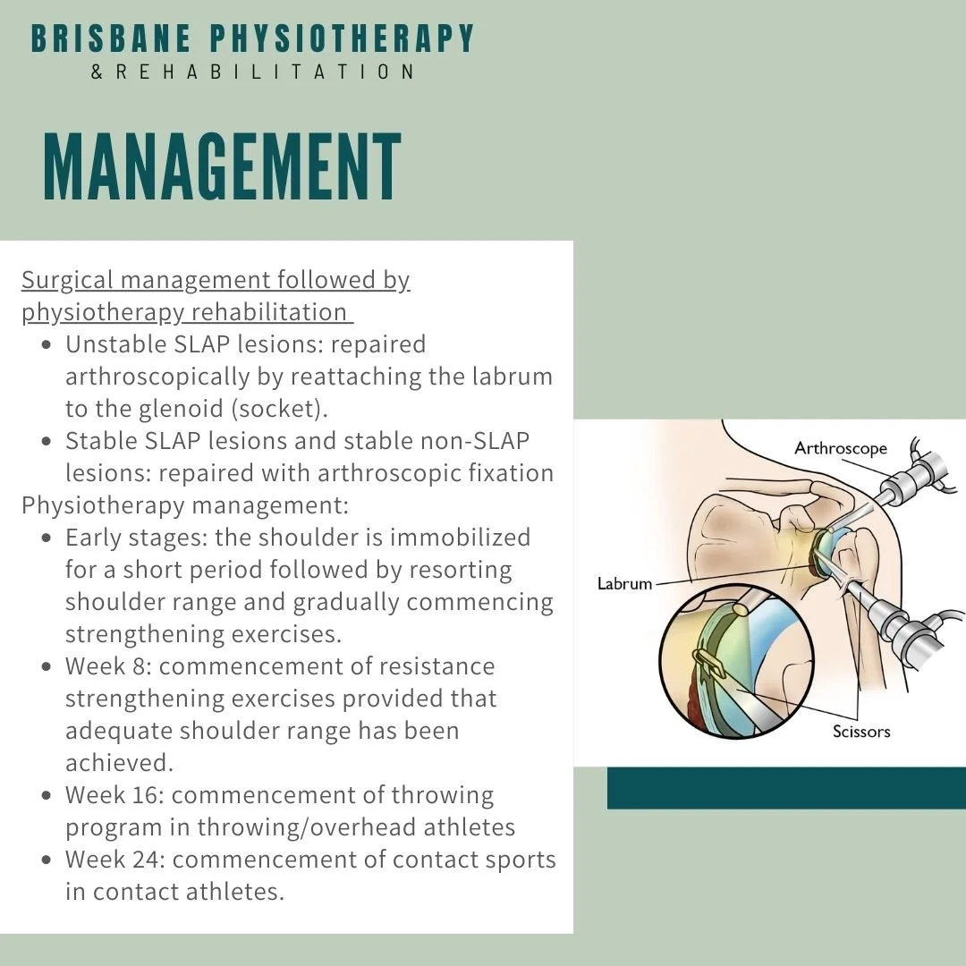 Managing your Shoulder Glenoid Labrum Injury - Brisbane Physiotherapy