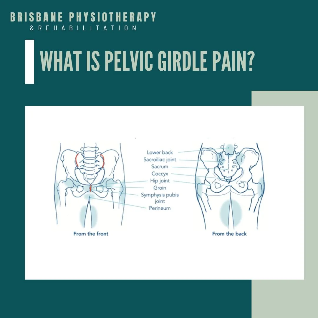 What is Pelvic Girdle Pain? - Brisbane Physiotherapy & Podiatry