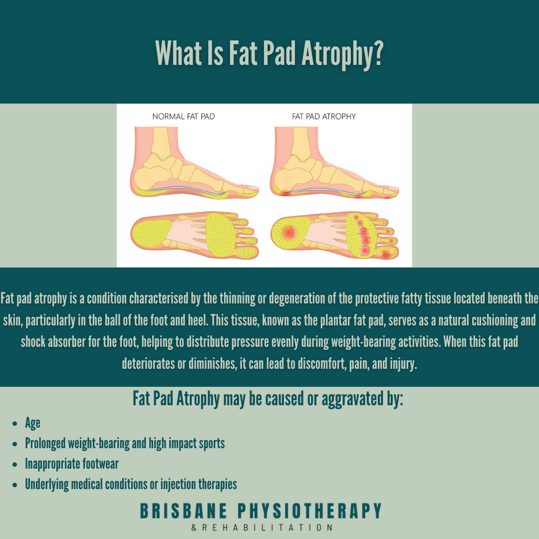 Fat Pad Atrophy - Symptoms, Treatment, Management - Brisbane ...