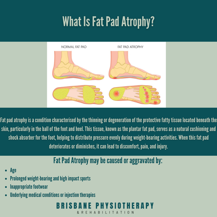 Fat Pad Atrophy - Symptoms, Treatment, Management - Brisbane ...