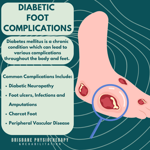 Diabetic Foot Complications - Brisbane Physiotherapy & Podiatry