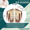 Rib Injuries: Understanding Causes, Symptoms, and Physiotherapy ...