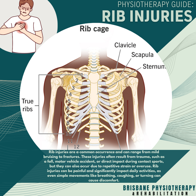 Rib Injuries: Understanding Causes, Symptoms, and Physiotherapy ...