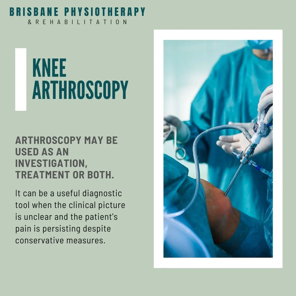 Knee Arthroscopy - Arthroscopic Knee Surgery Recovery & Physio ...