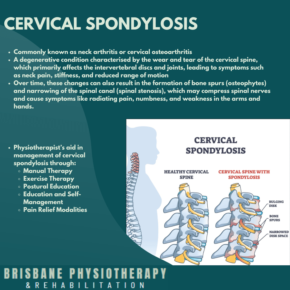 What Is Cervical Spondylosis? - Brisbane Physiotherapy & Podiatry