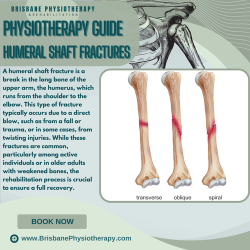 Physiotherapy Guide: Humeral Shaft Fractures - Brisbane Physiotherapy ...