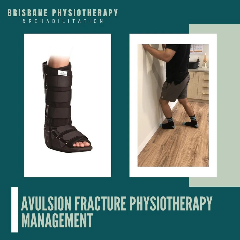 Avulsion Fractures - What are they? Symptoms, Diagnosis, Treatment, Physio & Rehab - Brisbane ...