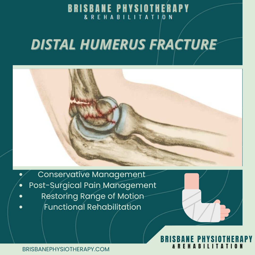 Distal Humerus Fracture: Recovery and Rehabilitation - Brisbane ...