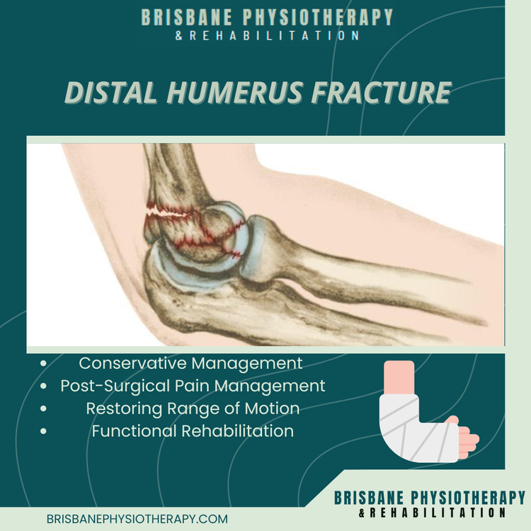 Distal Humerus Fracture: Recovery and Rehabilitation - Brisbane ...