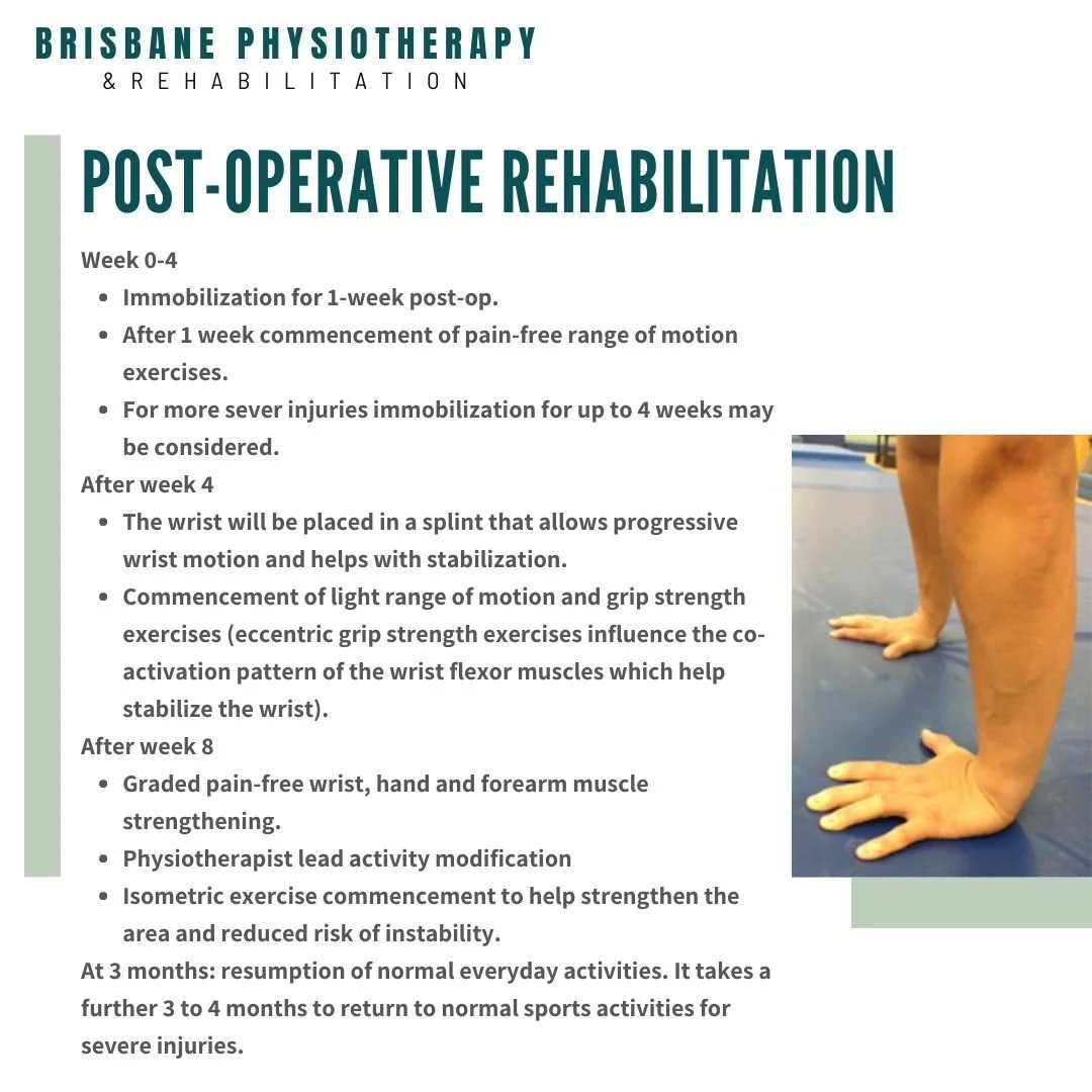 Managing your TFCC tear - Brisbane Physiotherapy