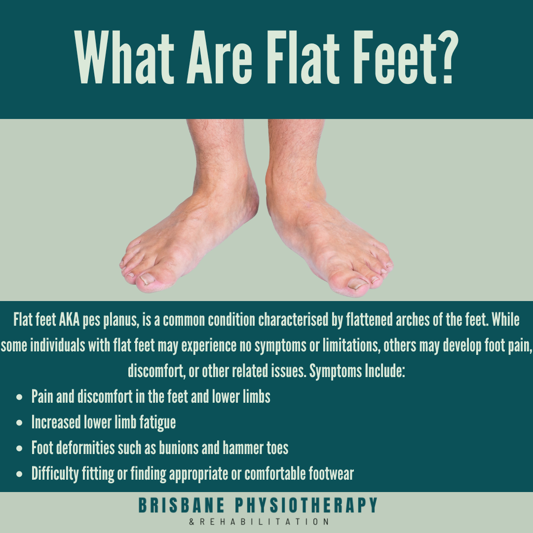 Flat Feet - Causes, Symptoms & Treatment - Brisbane Physiotherapy ...