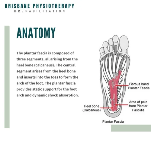 Plantar Fasciitis - What is it? Symptoms, Treatment, Rehab & Physio ...