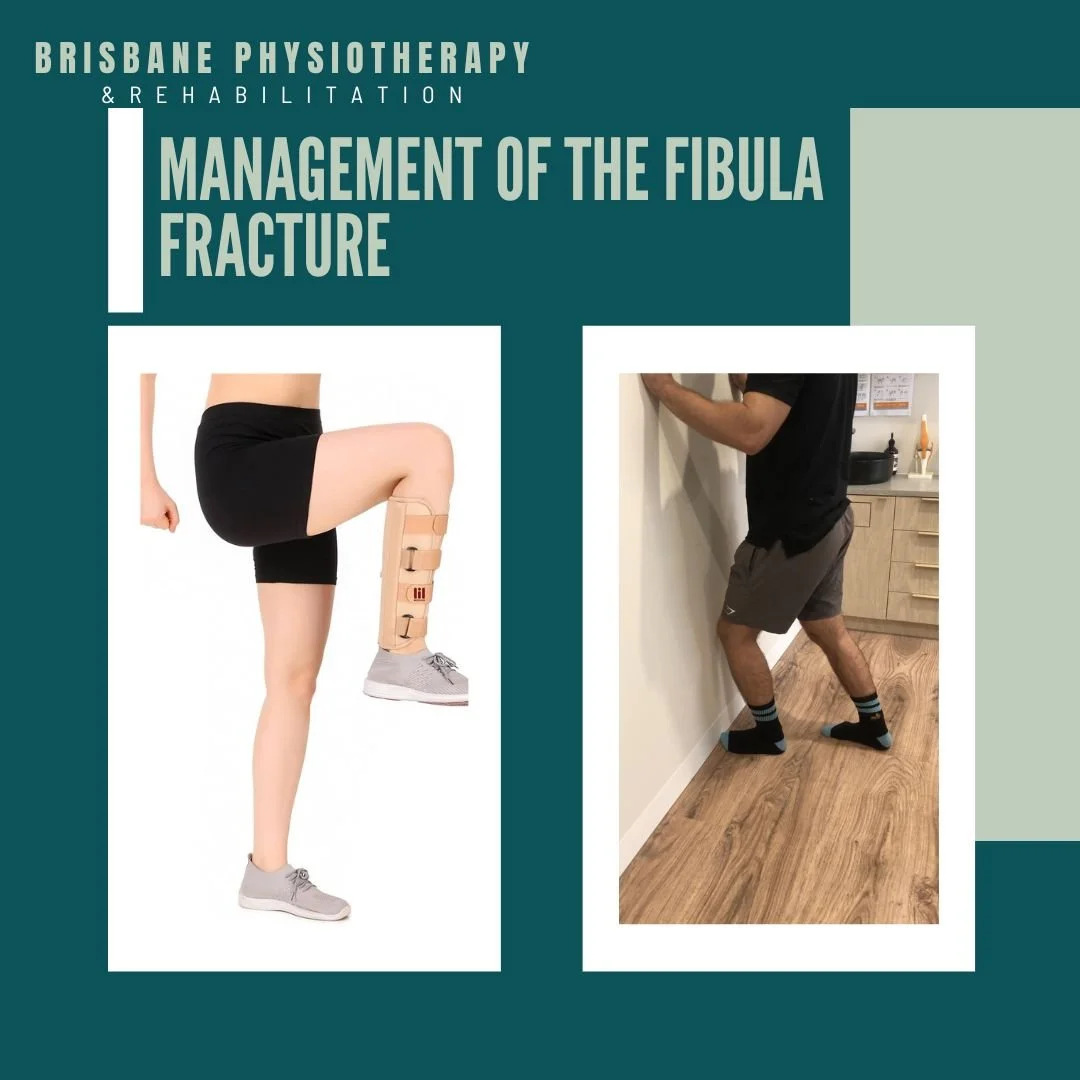 What is a Fibula Fracture? - Brisbane Physiotherapy & Podiatry