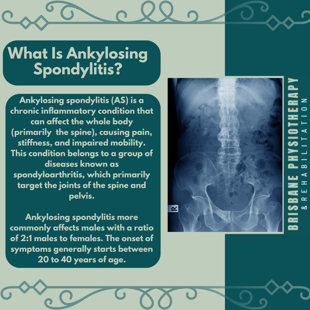What is Ankylosing Spondylitis? - Brisbane Physiotherapy & Podiatry