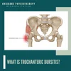 Trochanteric Bursitis - What is it? Symptoms, Treatment & Physio ...