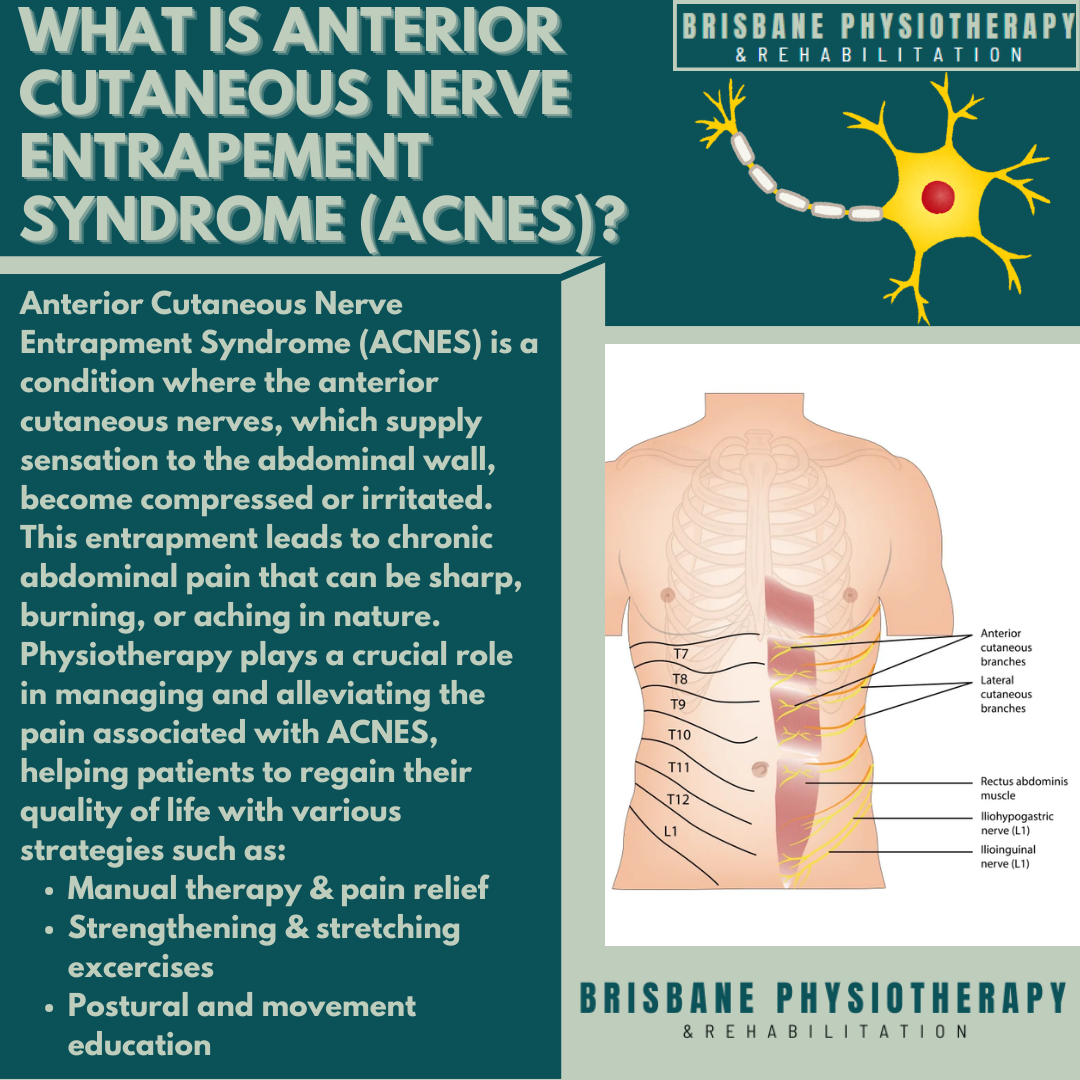 Understanding Anterior Cutaneous Nerve Entrapment Syndrome And