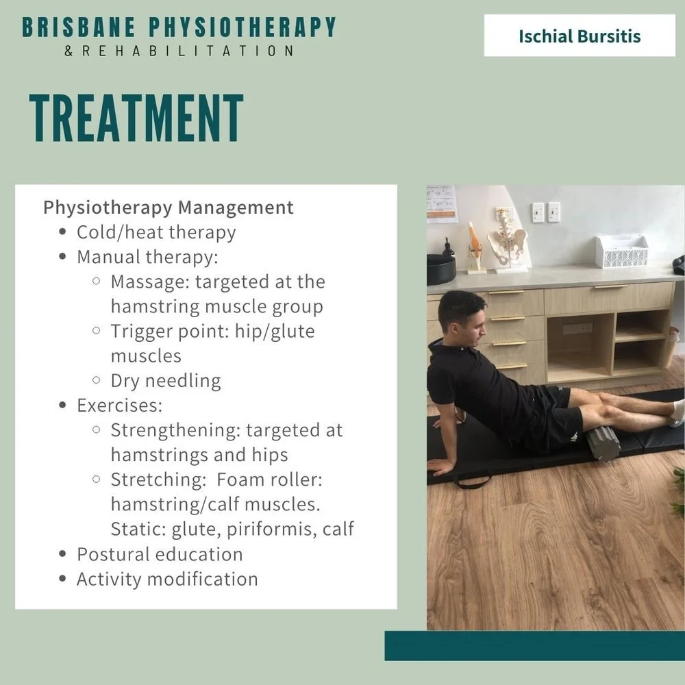 Ischial Bursitis - What is it? Symptoms, Treatment & Physio - Brisbane ...