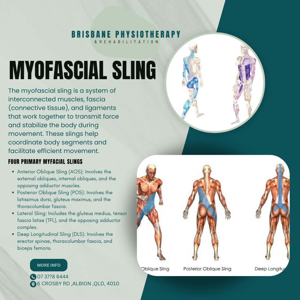 Myofascial Sling - Brisbane Physiotherapy & Podiatry