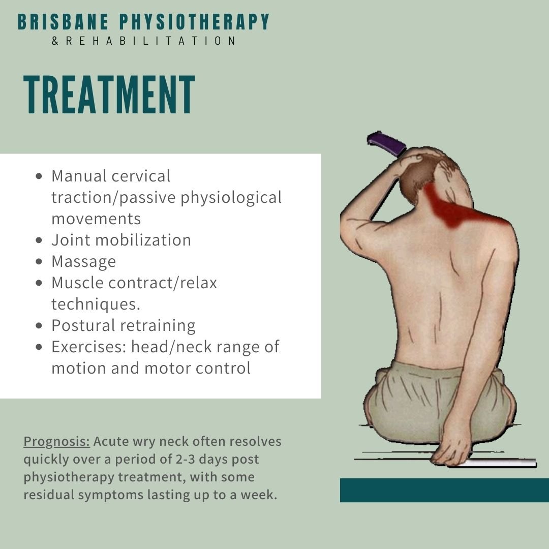 Managing your Wry Neck - Brisbane Physiotherapy Managing your Wry Neck - Brisbane Physiotherapy