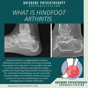 Hindfoot Arthritis: Understanding, Symptoms, and Physiotherapy ...