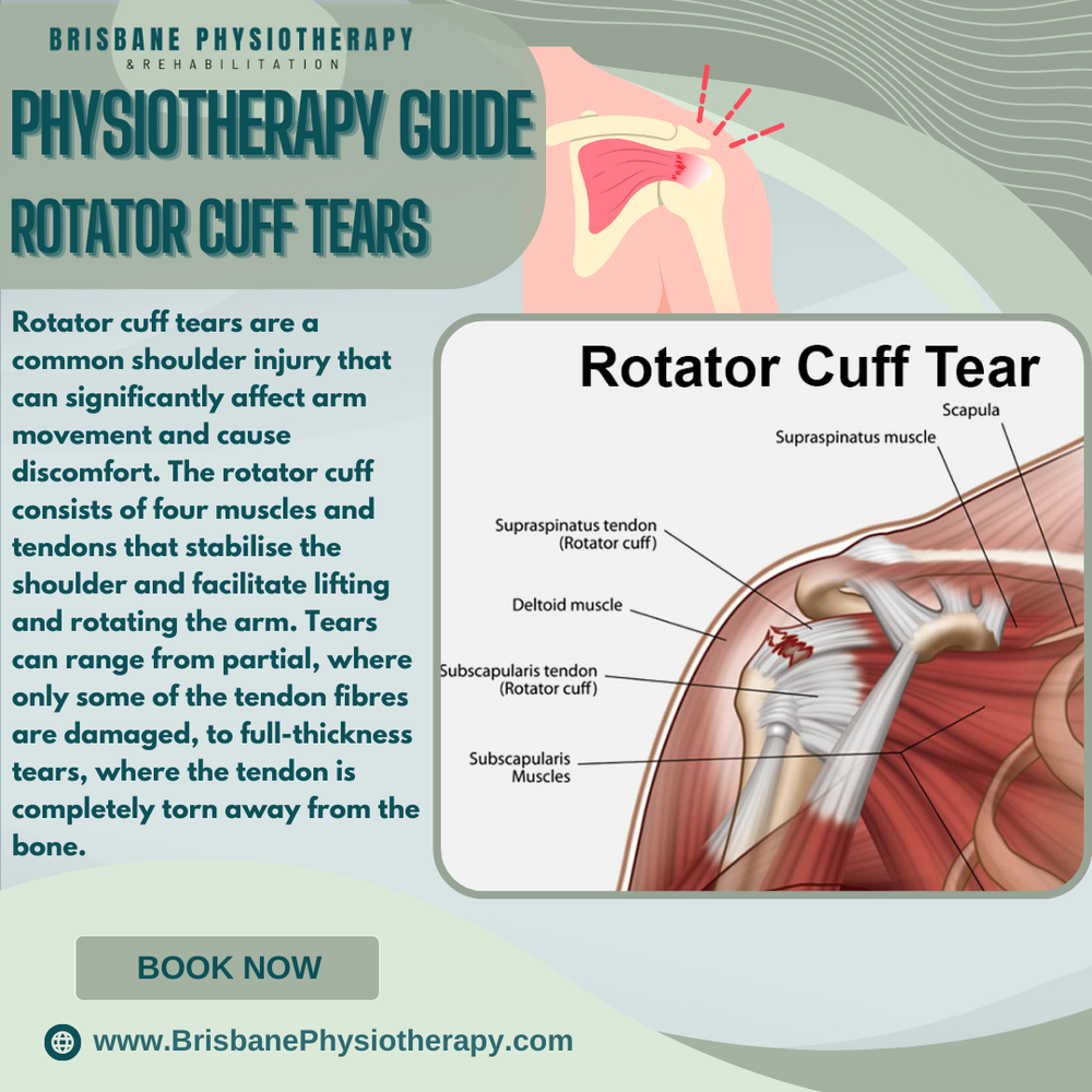 Rotator Cuff Tears: Understanding Partial and Full Tears and the Role ...