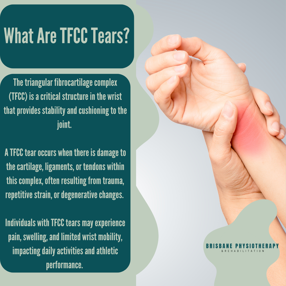TFCC Tear - Triangular Fibrocartilage Complex - Symptoms, Treatment, Rehab Exercises - Brisbane ...