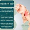 TFCC Tear - Triangular Fibrocartilage Complex - Symptoms, Treatment, Rehab Exercises - Brisbane ...