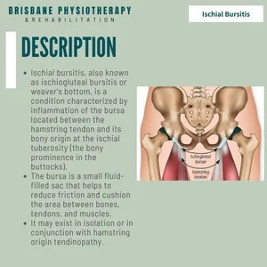 Ischial Bursitis - What is it? Symptoms, Treatment & Physio - Brisbane ...