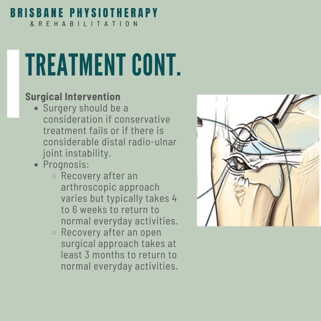 Managing your TFCC tear - Brisbane Physiotherapy