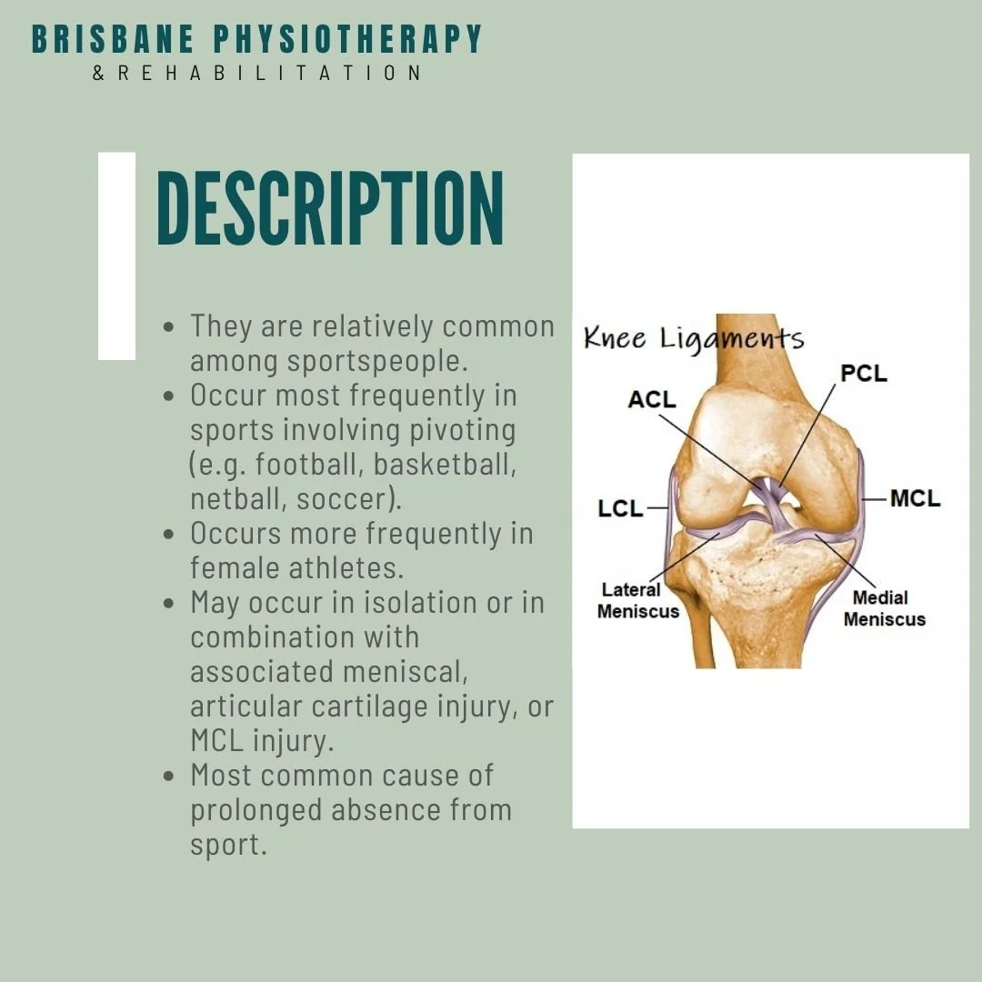 What is an ACL injury? - Brisbane Physiotherapy