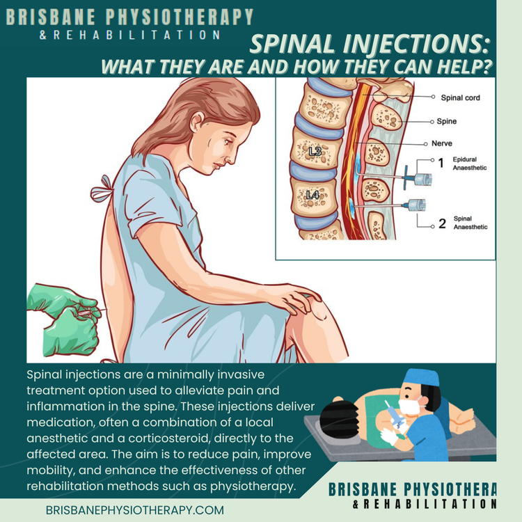 Spinal Injections: What They Are and How They Can Help - Brisbane ...