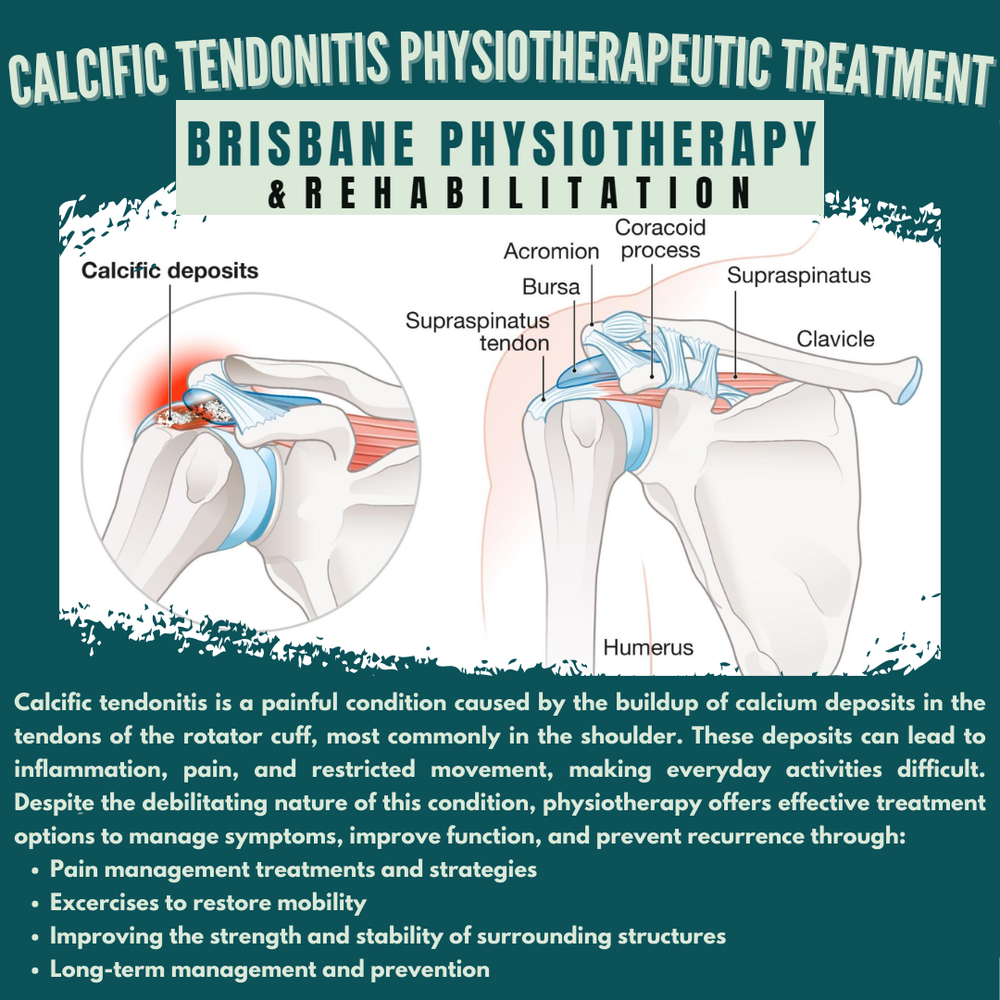 What is Calcific Tendonitis? - Brisbane Physiotherapy & Podiatry