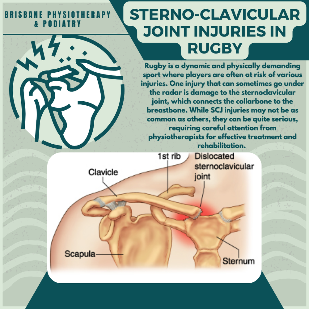 Sterno-Clavicular Joint Injuries in Rugby: The Physiotherapy ...