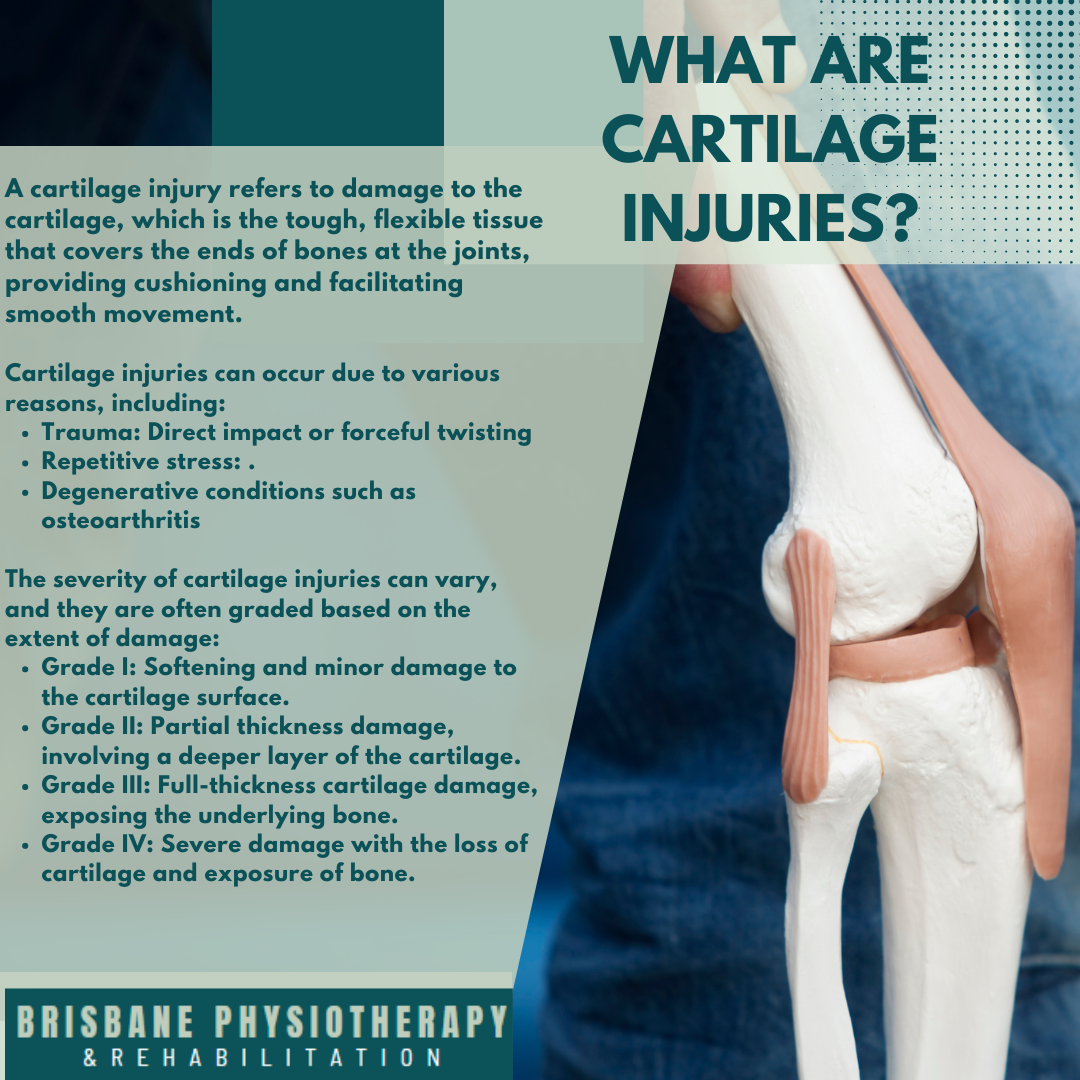 What Are Cartilage Injuries? - Brisbane Physiotherapy & Podiatry