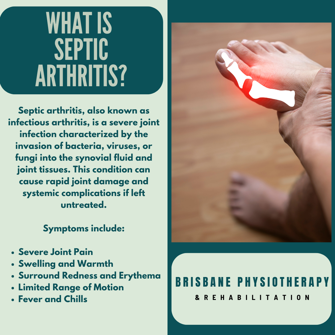 What Is Septic Arthritis Brisbane Physiotherapy Podiatry