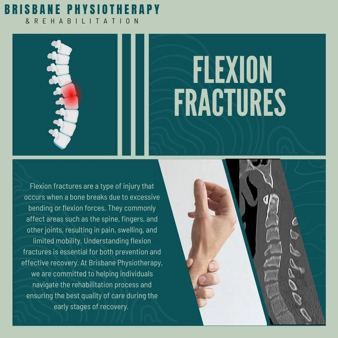 Flexion fractures - Brisbane Physiotherapy & Podiatry
