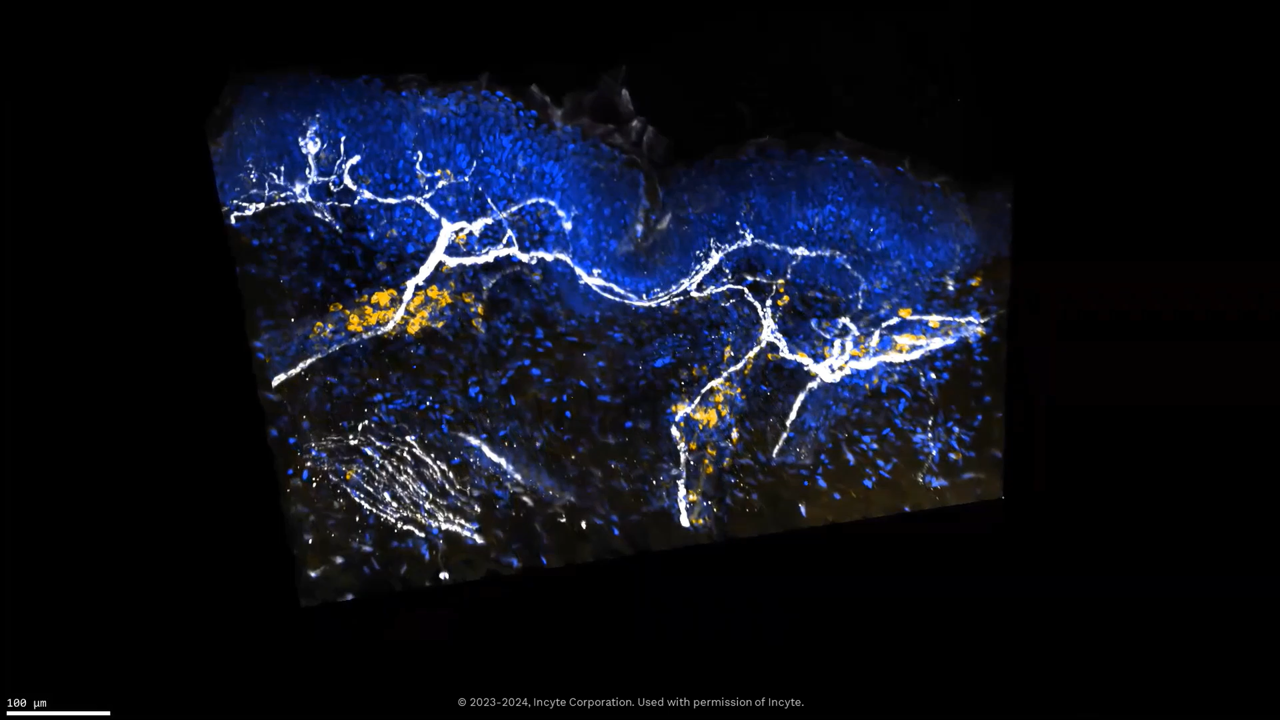 3D Tissue Imaging Insights & Digital Pathology Blog | Alpenglow ...