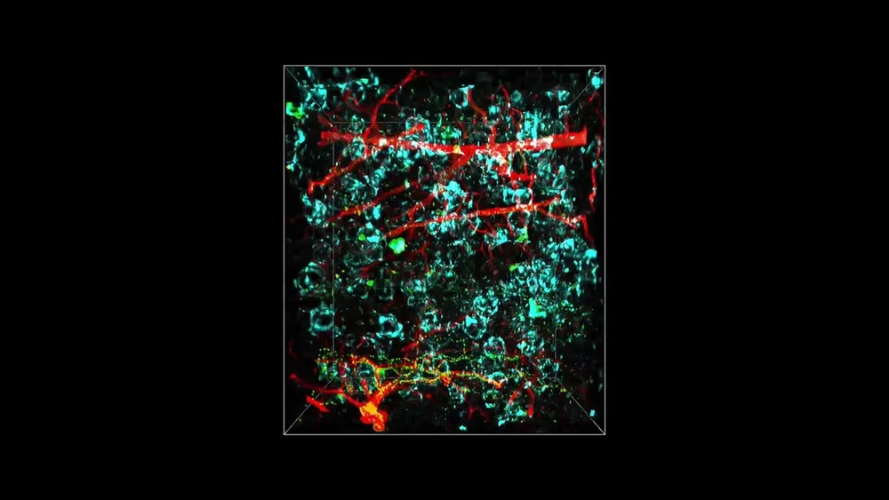 3D Tissue Imaging & AI-Powered Digital Pathology