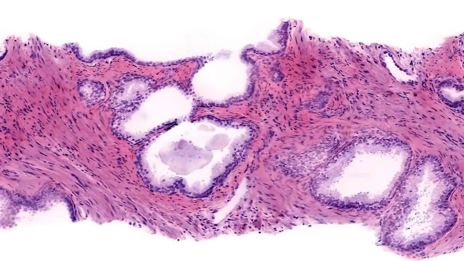 3D Tissue Imaging & AI-Powered Digital Pathology