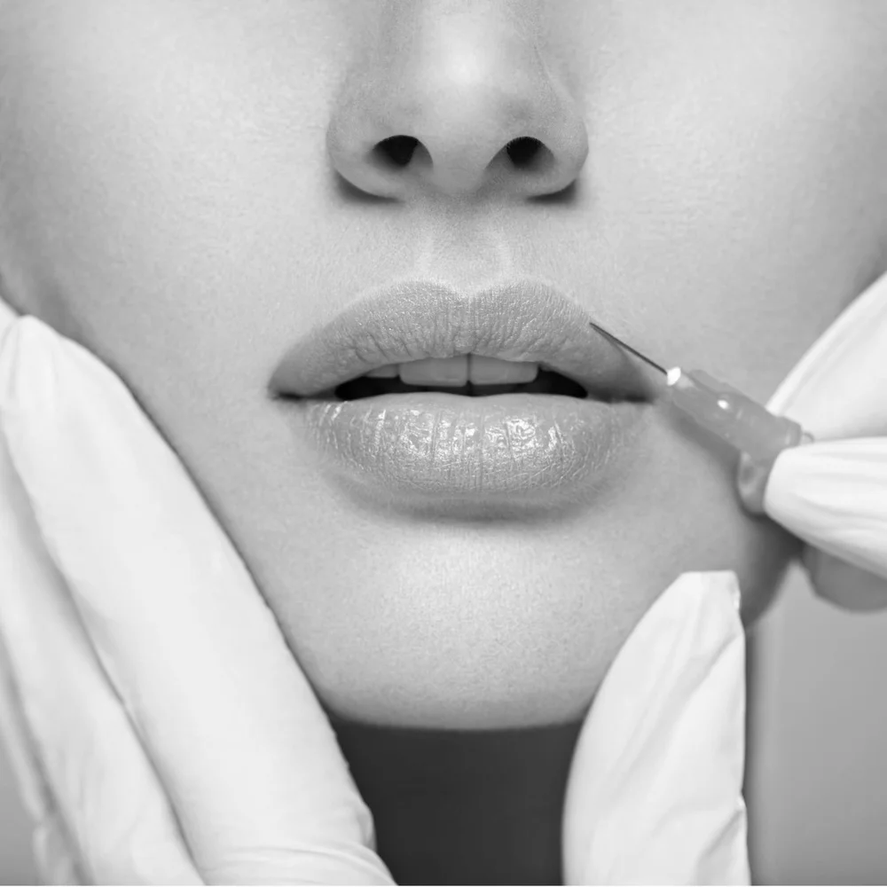 TrapTox AKA Barbie Botox — PLUMP MEDICAL SPA