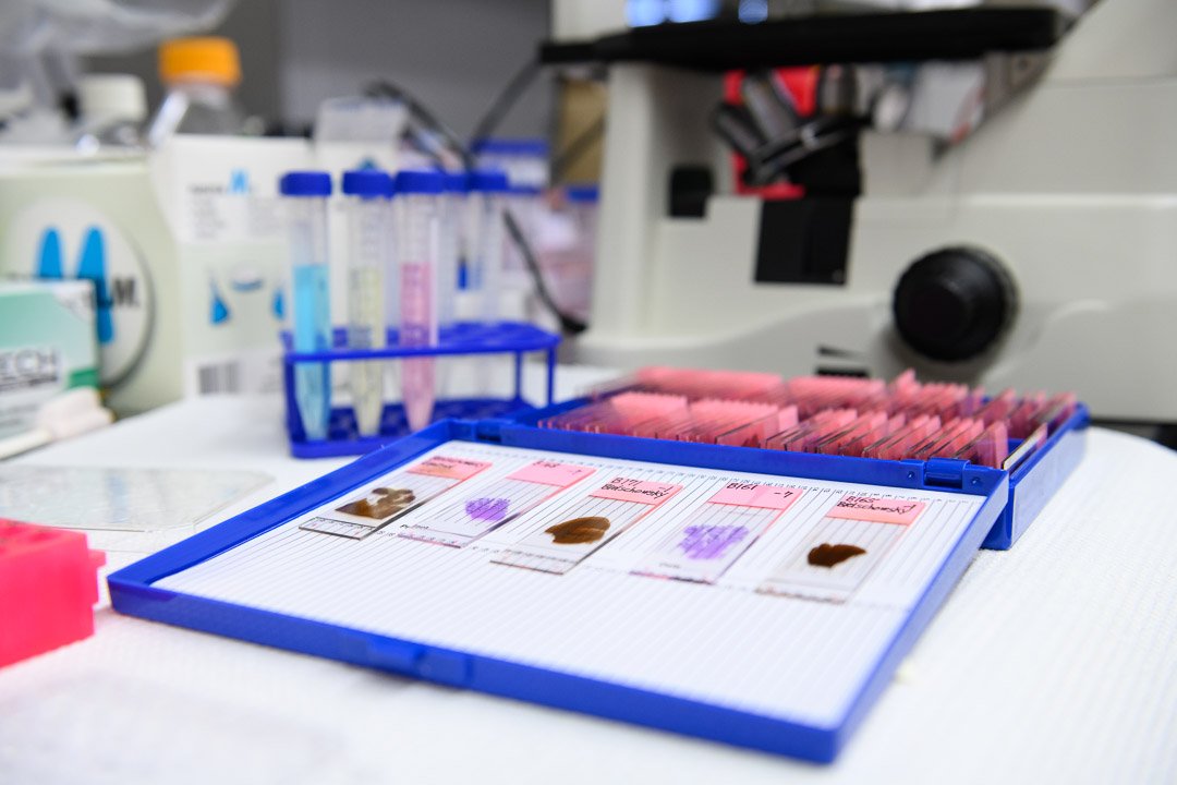 McKee Foundation Awards $20,000 Research Grant to TTUHSC El Paso’s ...