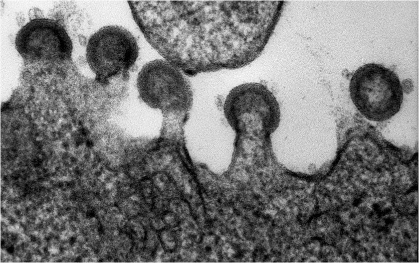 UvS Prize — Sundquist Lab
