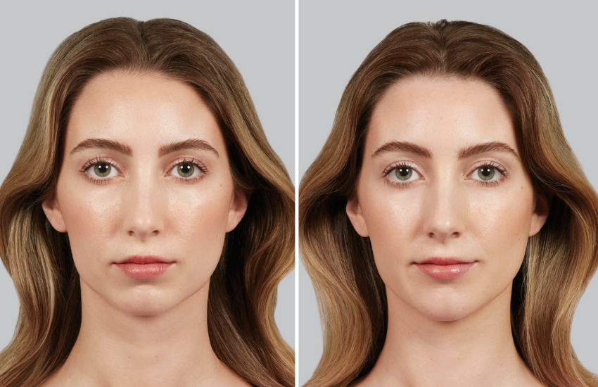 Injectables — Medical Aesthetics, Ltd.