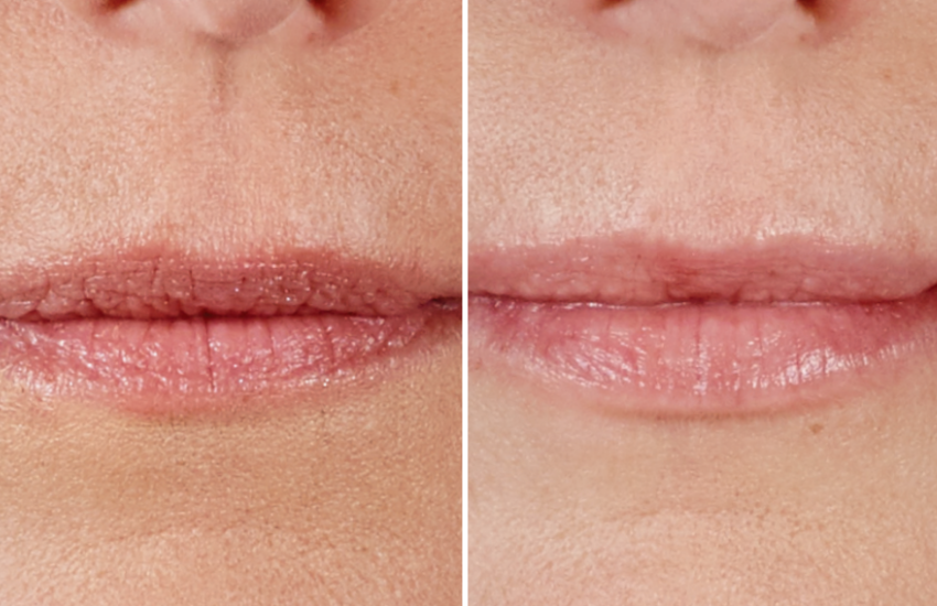 Injectables — Medical Aesthetics, Ltd.