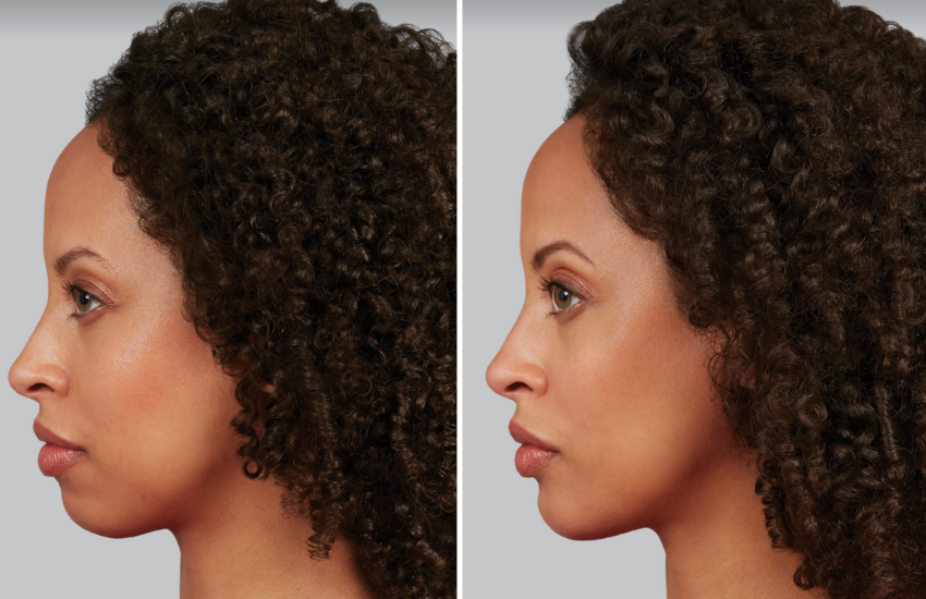 Injectables — Medical Aesthetics, Ltd.