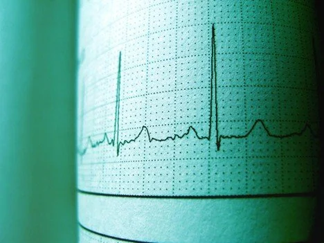 Why Cardiac Clearance Before Surgery Could Save Your Life — Taylormade