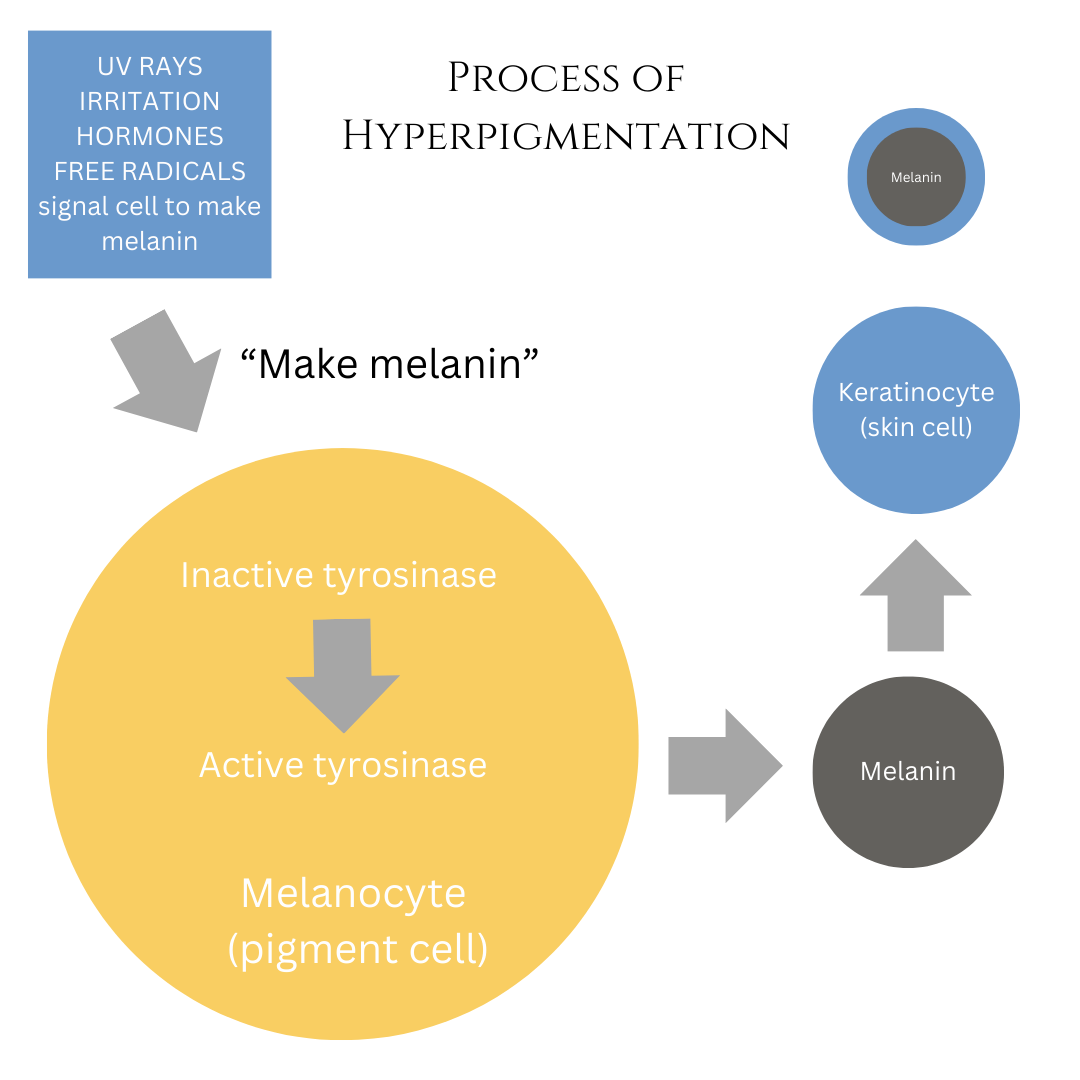 Excessive Pigmentation — SIMPLICITY Aesthetics