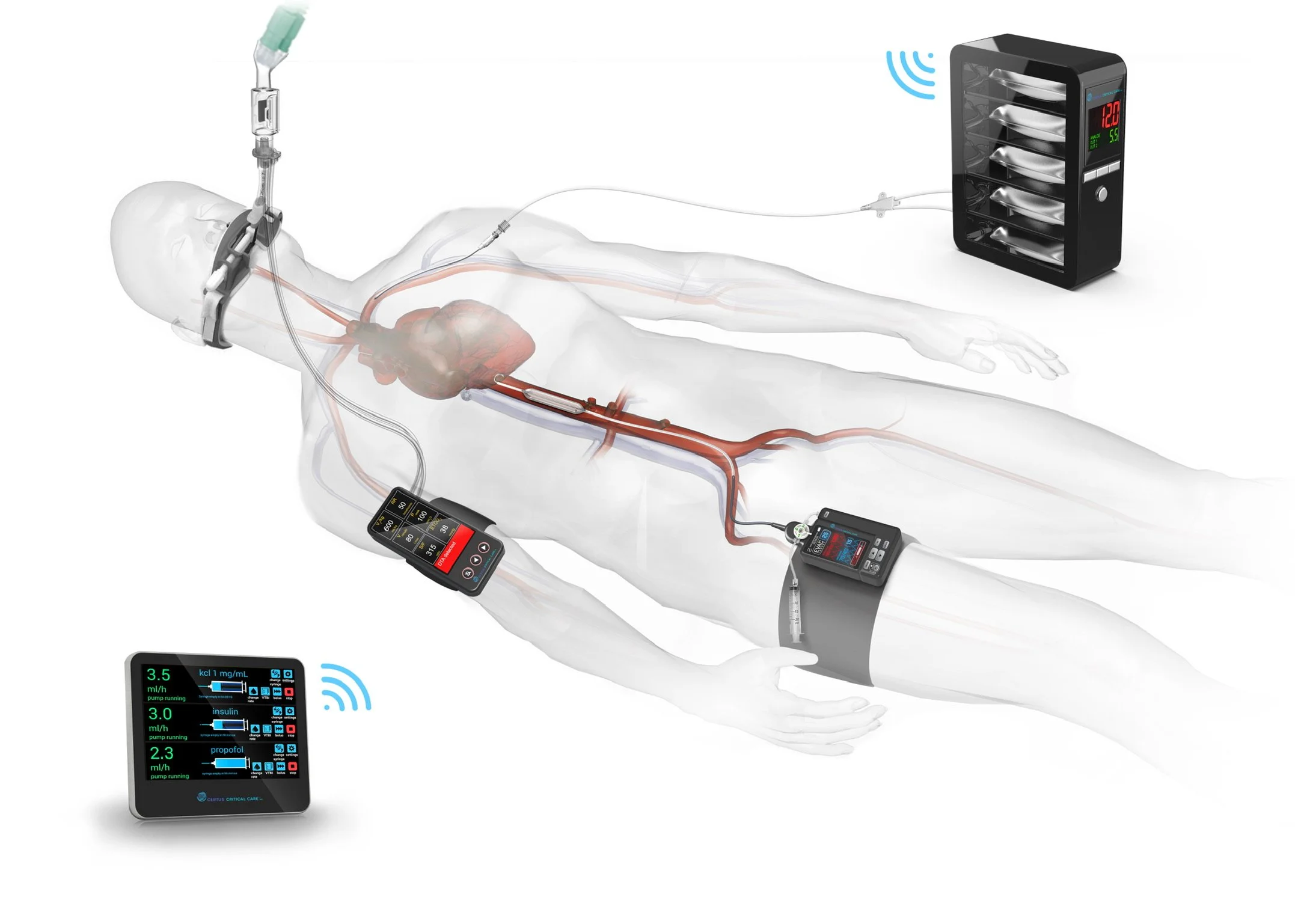 Our Story — Certus Critical Care, Inc.