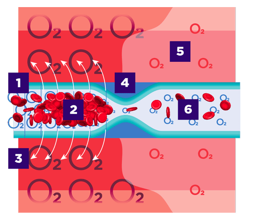 HBOT 101 — Hyperbaric NC